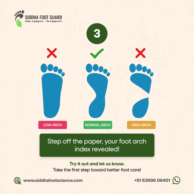 Do You Know Your Foot Arch Index? Here’s Why It Matters! - Siddha Foot ...